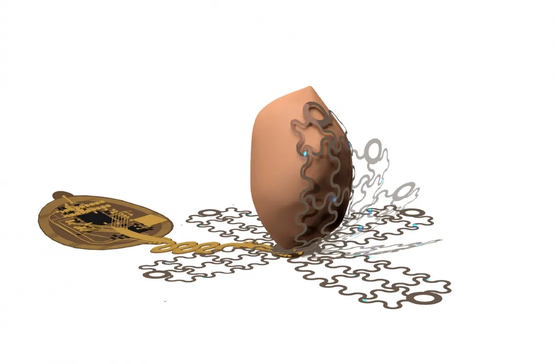 Battery-free, light-powered pacemaker may improve quality of life for ...